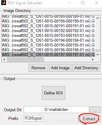 9-(图)利用Matlab的spm12工具处理fMRI为ROI | haoran's blog
