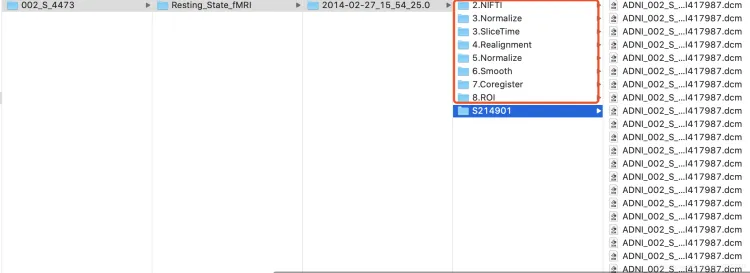 9-(图)利用Matlab的spm12工具处理fMRI为ROI | haoran's blog