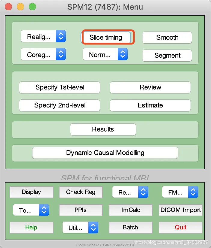 9-(图)利用Matlab的spm12工具处理fMRI为ROI | haoran's blog