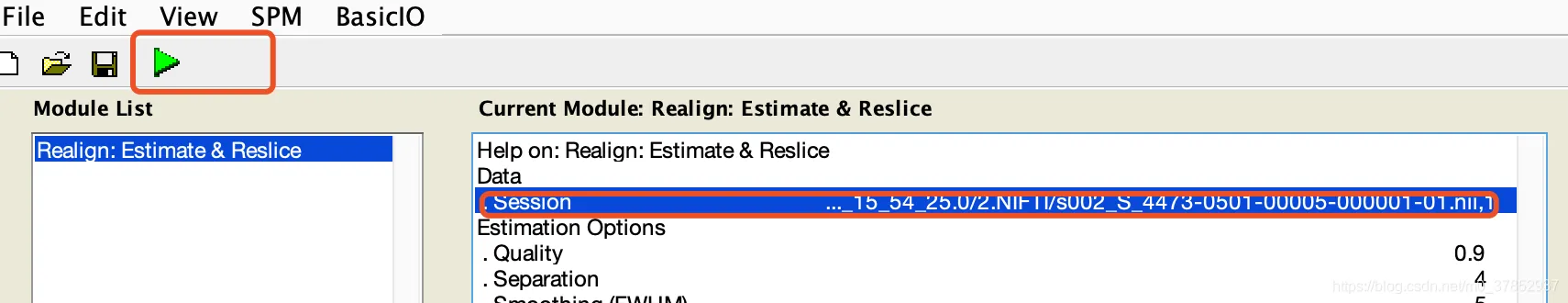 9-(图)利用Matlab的spm12工具处理fMRI为ROI | haoran's blog